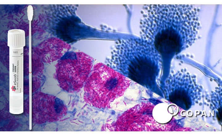 ESwab®是否能维持致病性分枝杆菌的生存能力 - raybetapp官网